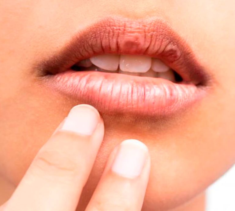 Acordar com a boca seca